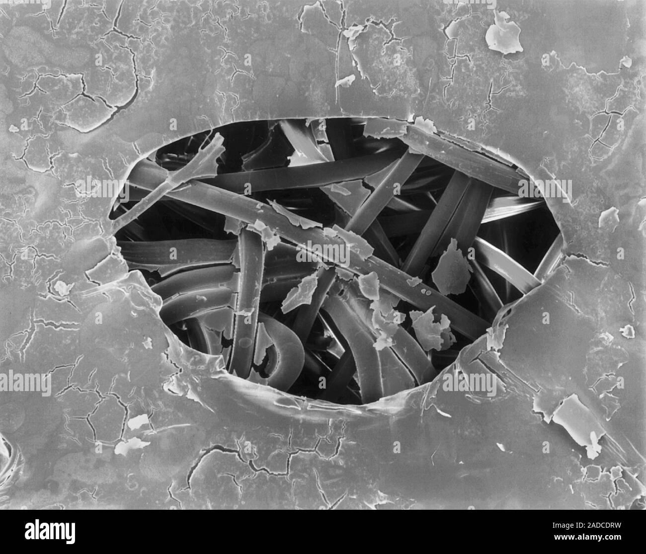 Band-aid inner surface with dried blood on the absorbent fibres ...