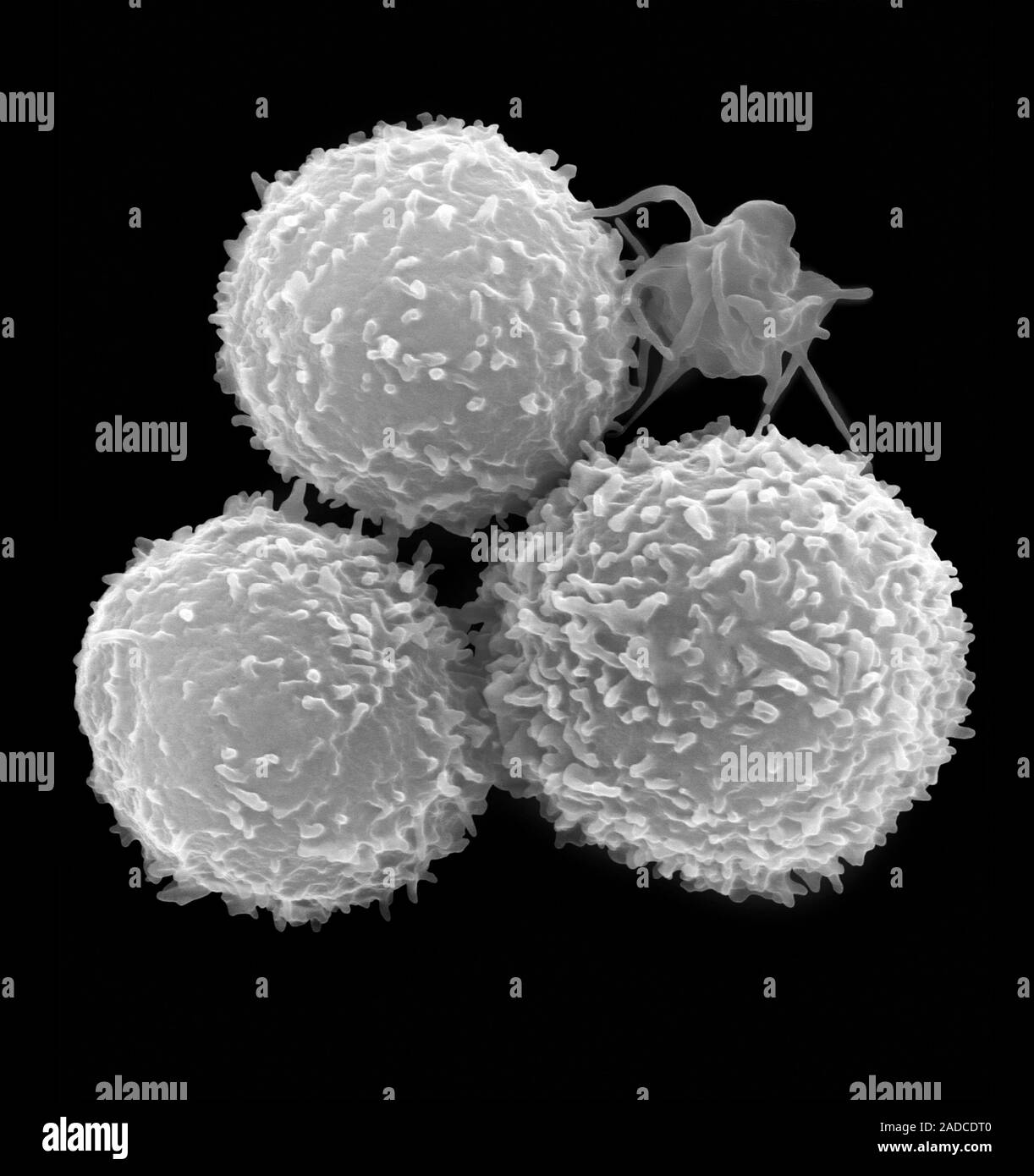 Human T lymphocytes (pre-T cells) and activated platelet, scanning ...