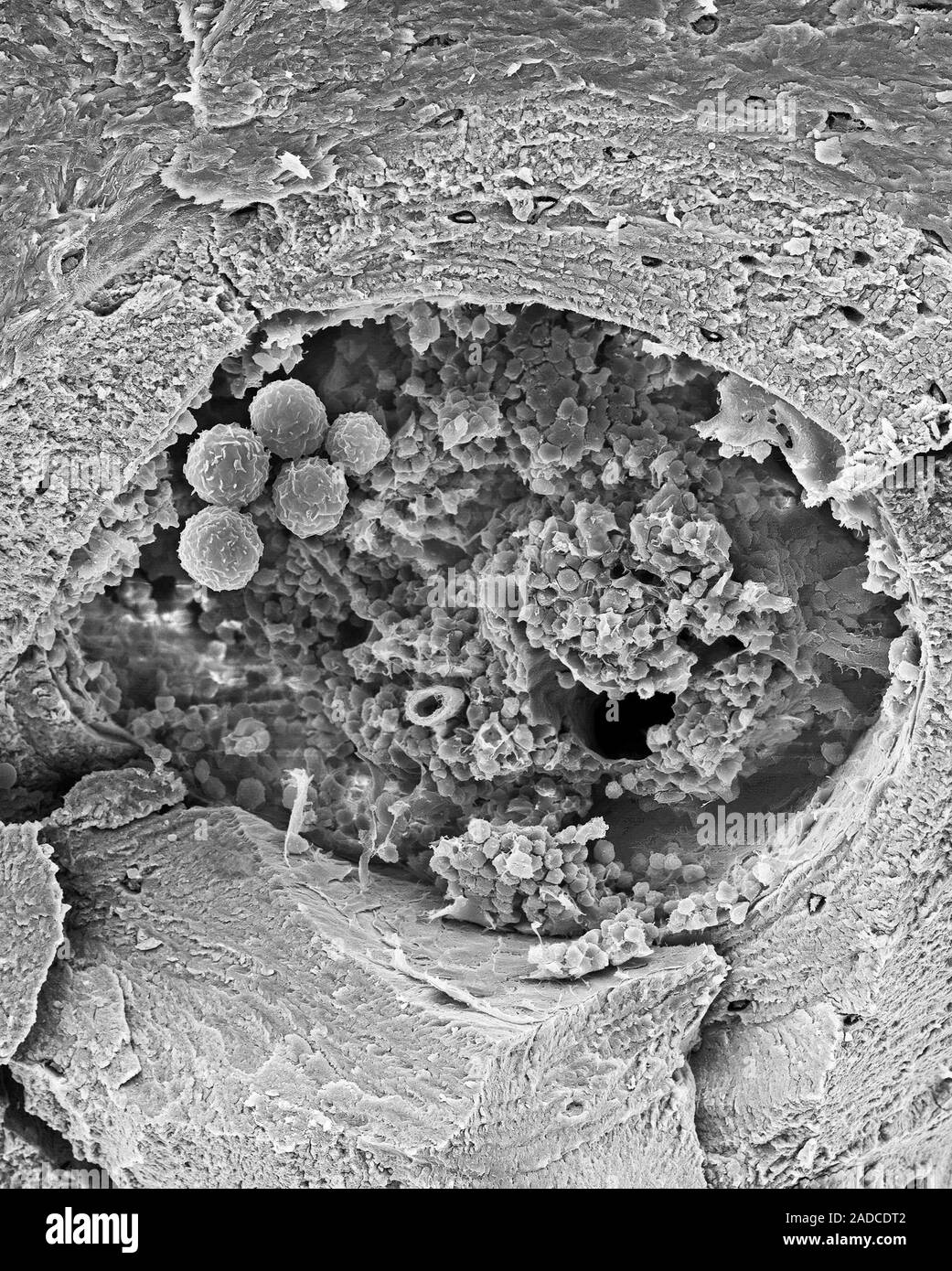 Photocomposite - Hematopoietic human stem cells (adult) in the bone ...