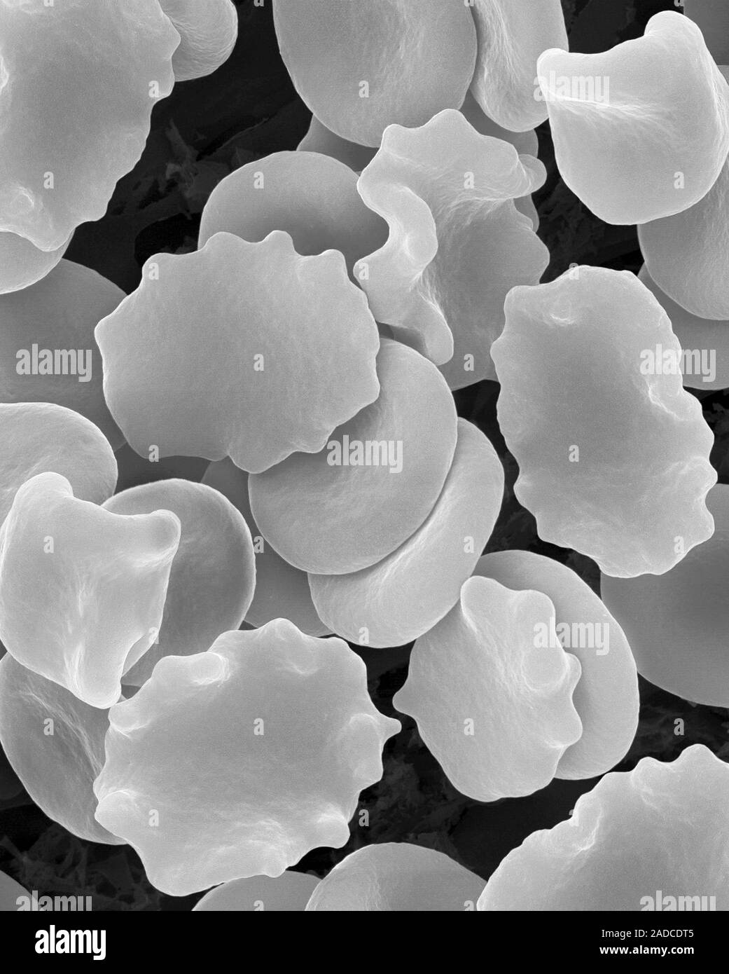 Red Blood Cells Microscope Hypertonic