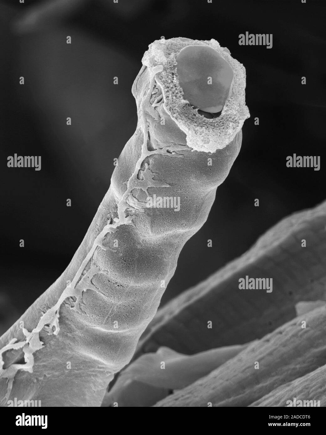 Capillary from heart muscle, scanning electron micrograph (SEM). Red ...