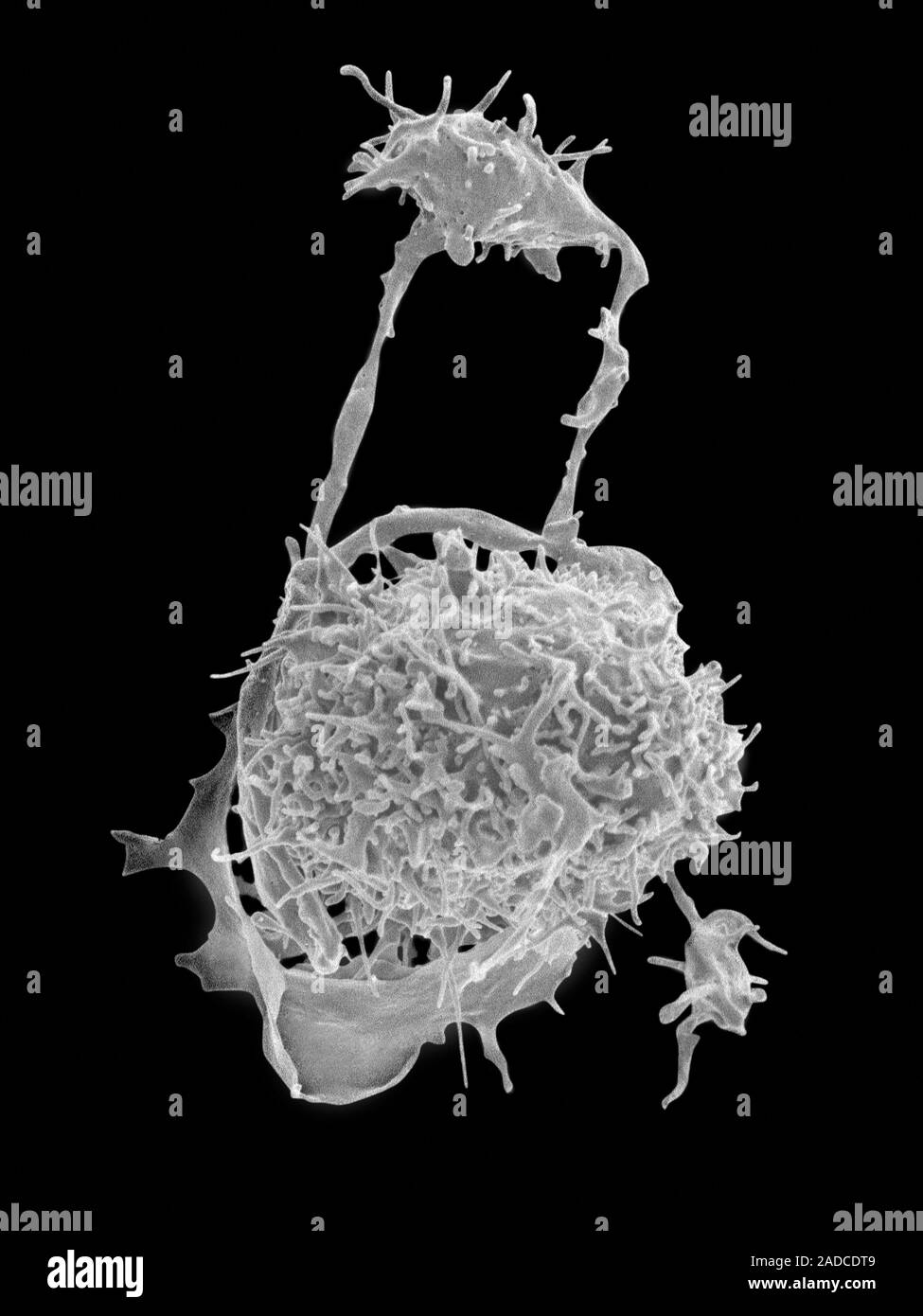 Human bone marrow megakaryocyte and platelet formation, scanning ...