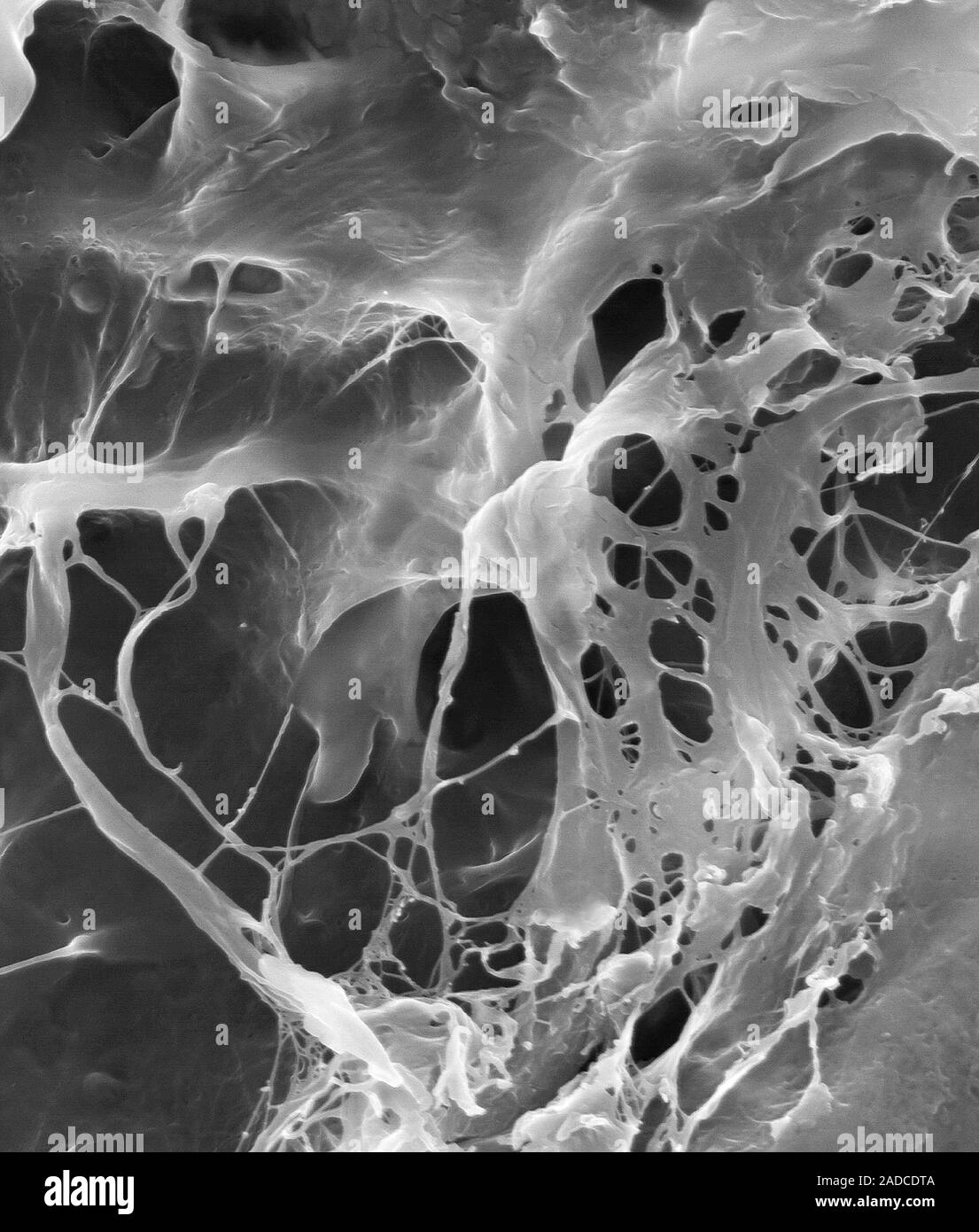 Extracellular matrix (ECM) produced by dermal fibroblasts, scanning ...