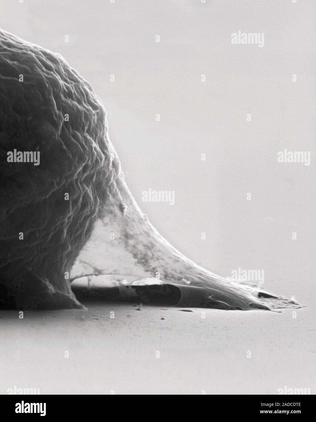 Muscle myoblast (primitive embryonic muscle cell) secreting ...