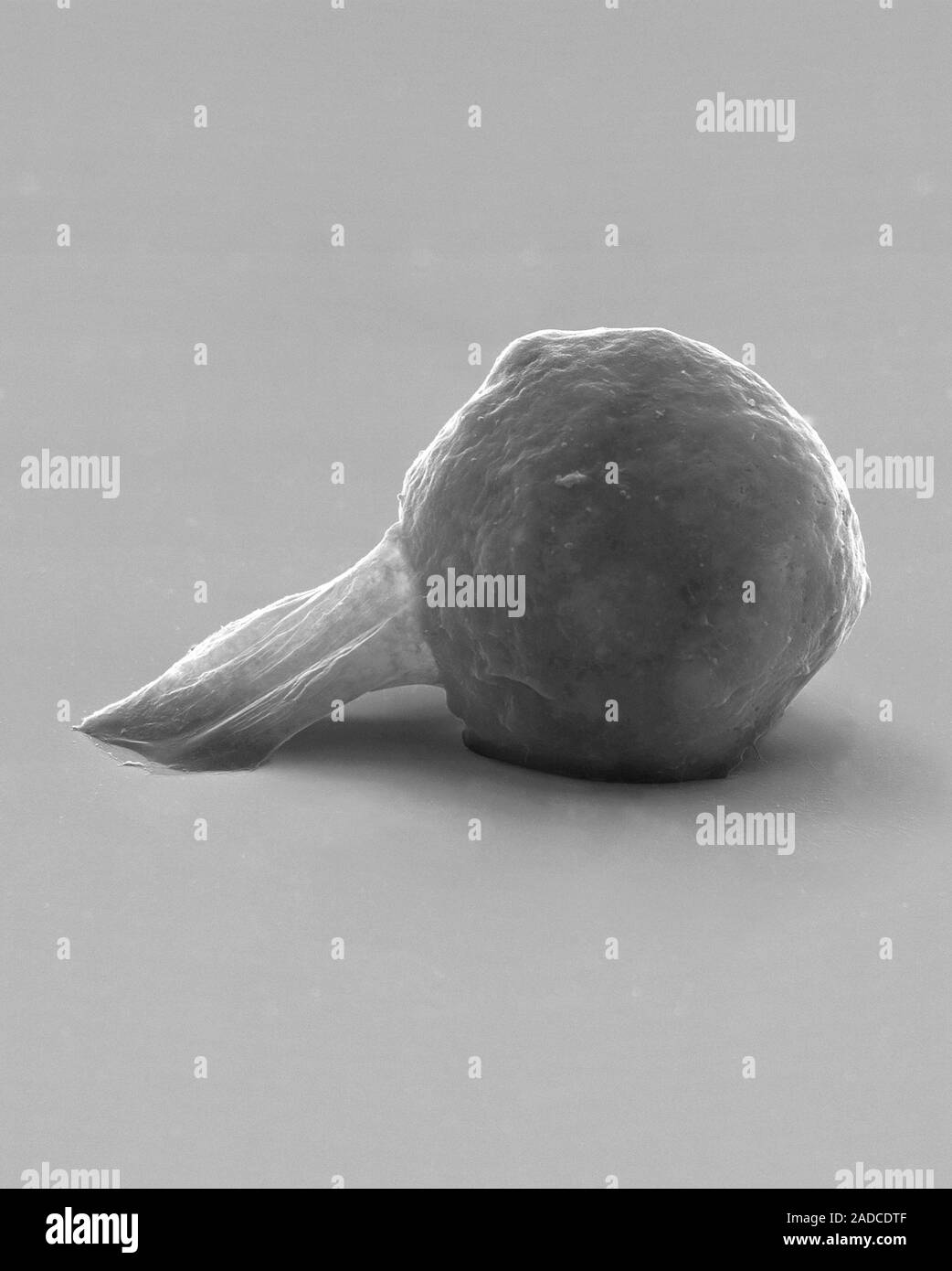 Muscle myoblast (primitive embryonic muscle cell) secreting ...