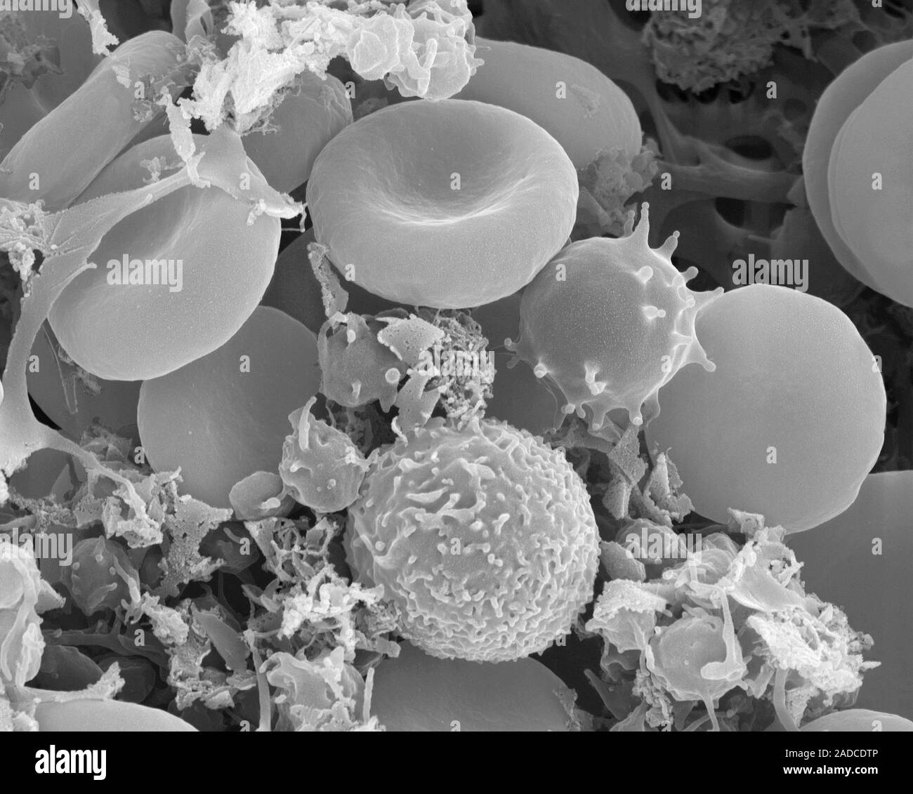 Human red blood cells, activated platelets, monocyte and T lymphocyte, scanning electron ...