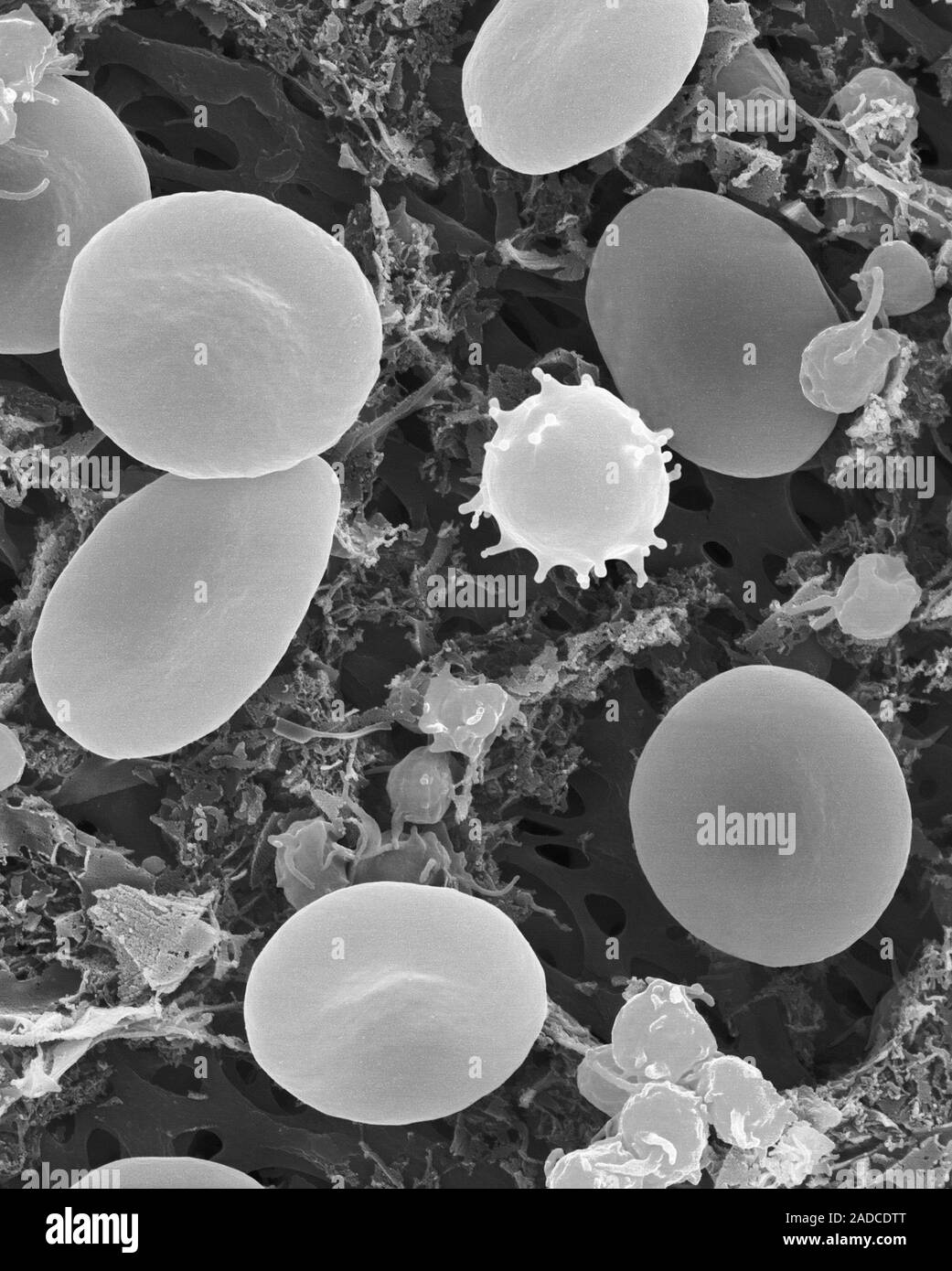 Human red blood cells, monocyte (white blood cell) and activated ...