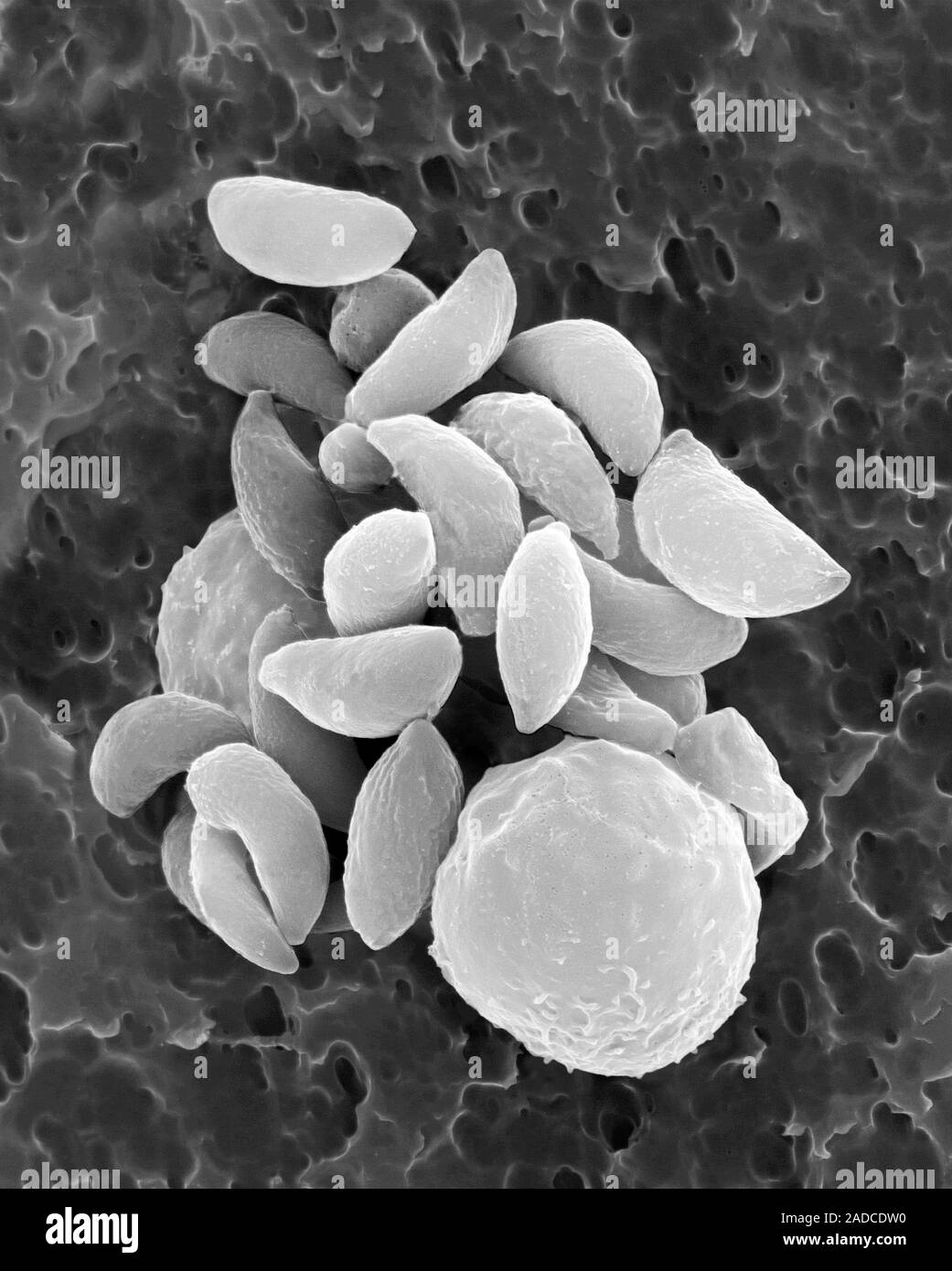 Parasitic tachyzoites (trophozoites) that cause toxoplasmosis in humans ...