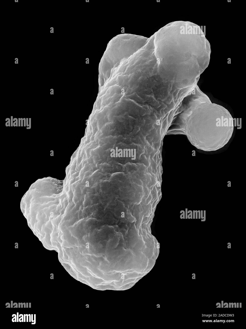 Parasitic amoeba (Entamoeba histolytica) causes amoebic dysentery & ulcers (vegetative ...