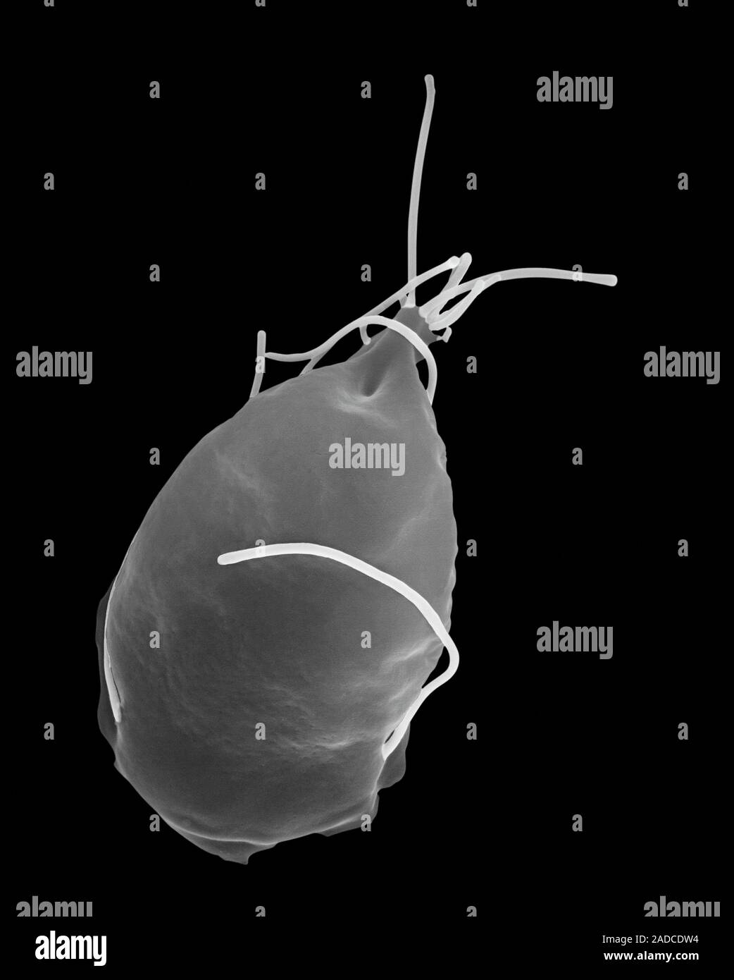 Giardia lamblia, a human parasite of the gastrointestinal tract ...