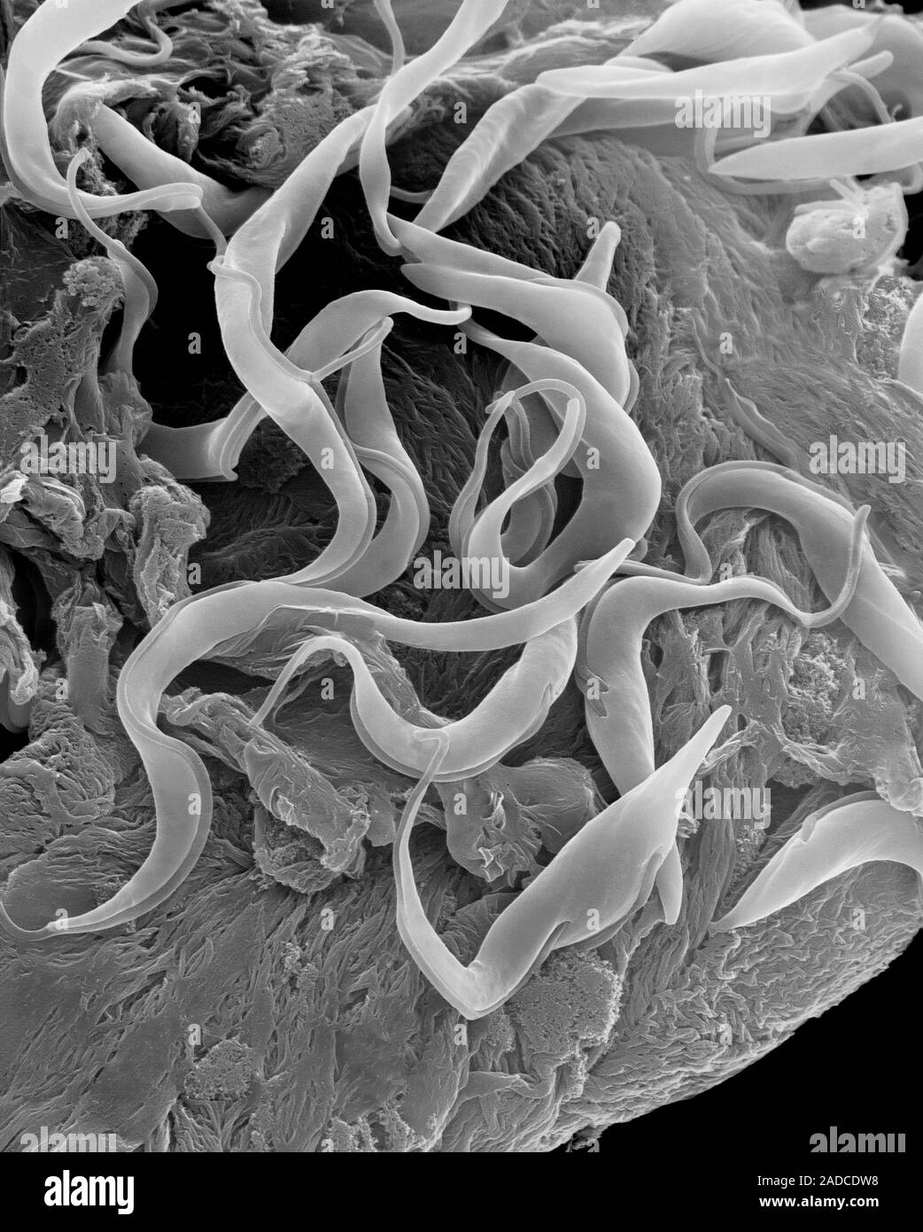 Trypanosome trypomastigote (Trypanosoma sp.), scanning electron ...