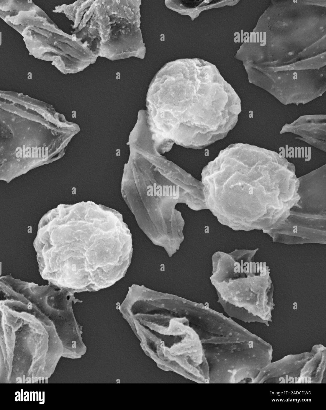 Plasmodium falciparum merozoites released from lysed red blood cells ...