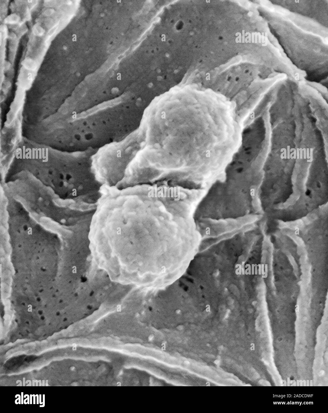 Plasmodium falciparum ring stage inside lysed red blood cell ...