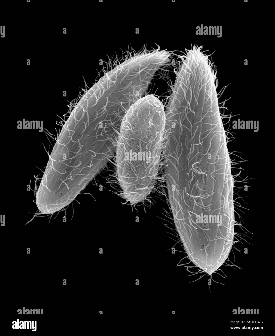 Ciliated protozoan (Tetrahymena vorax), scanning electron micrograph ...