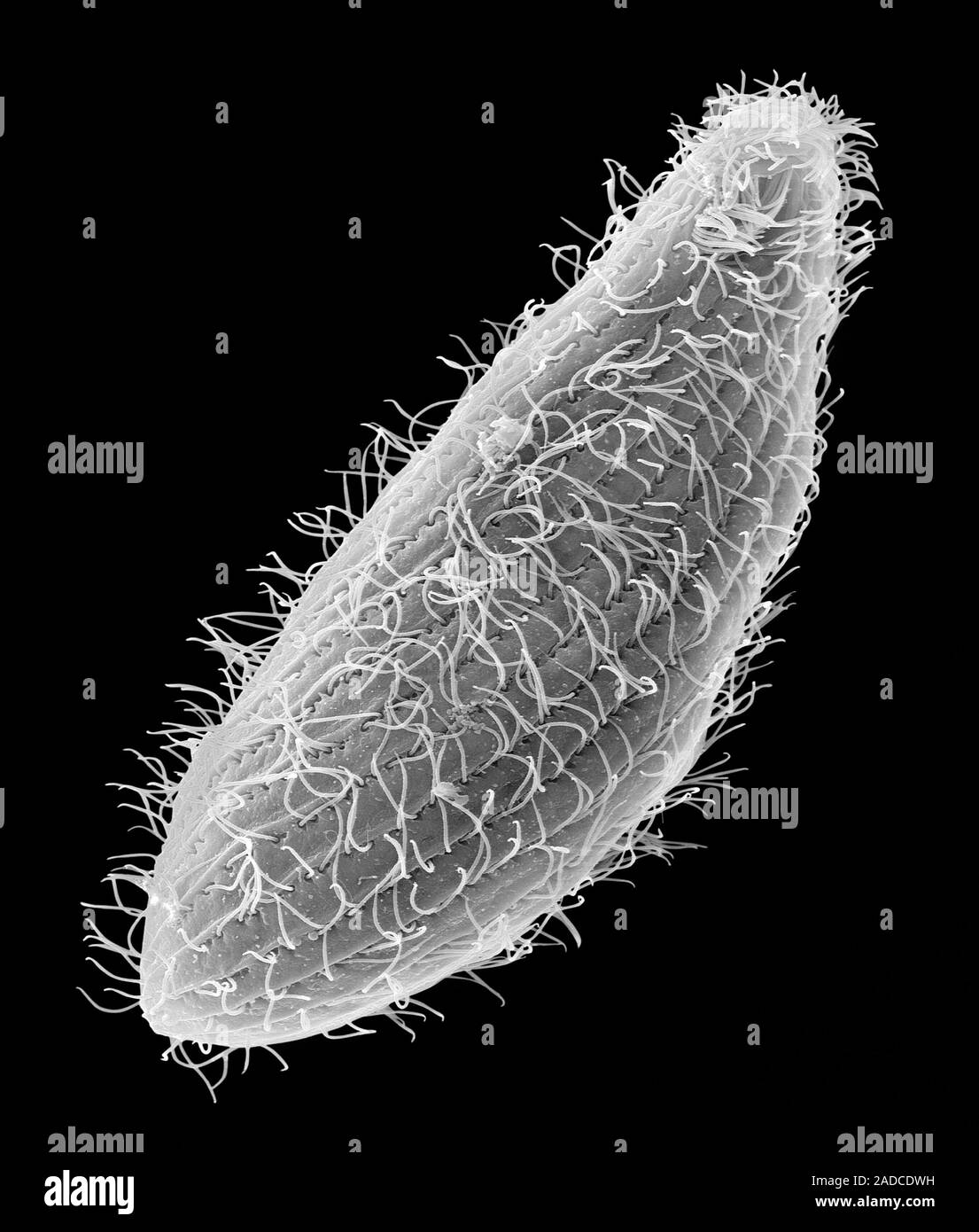 Ciliated protozoan (Tetrahymena thermophila), scanning electron ...