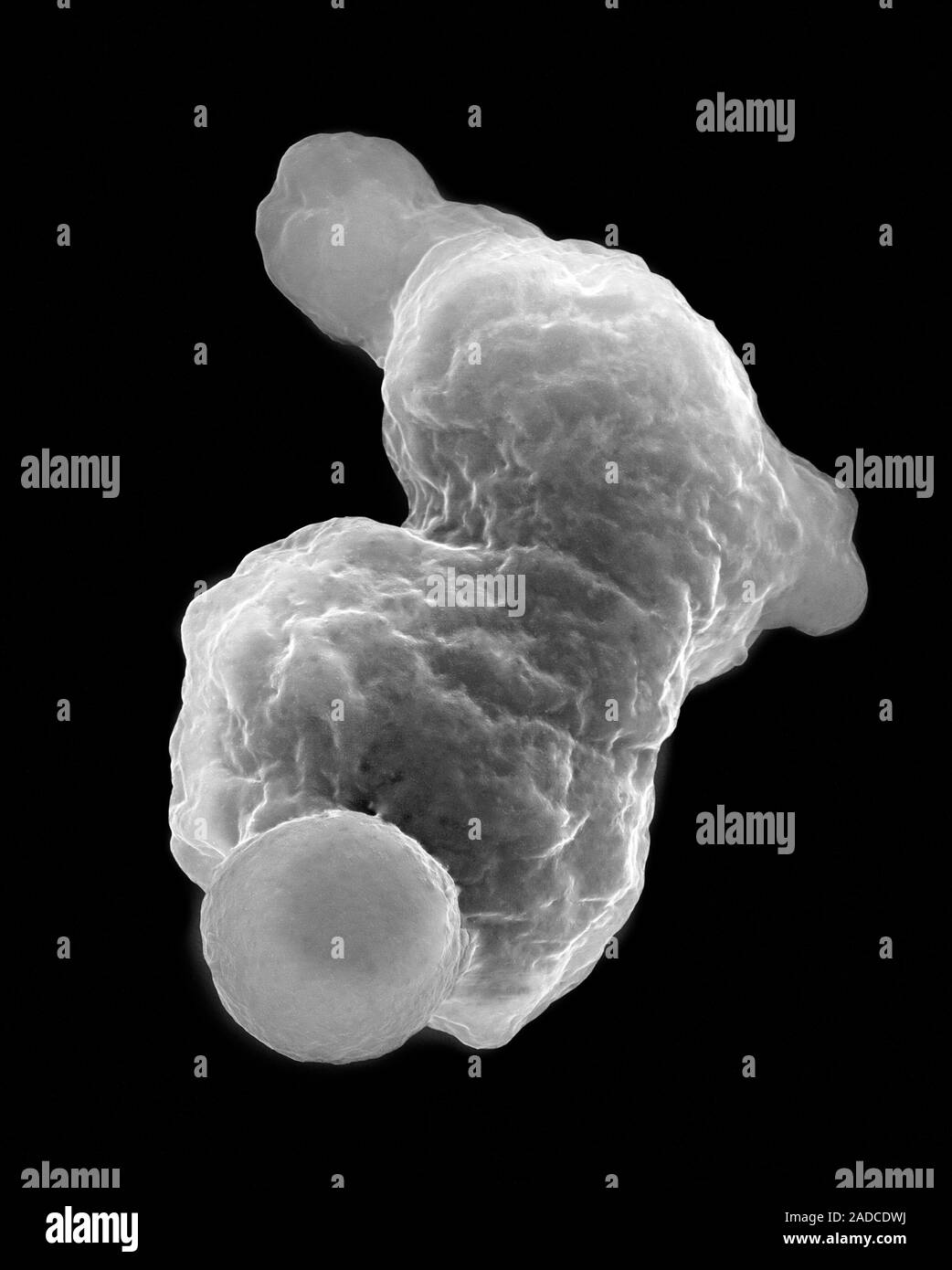 Entamoeba gingivalis, a parasitic pathogen (single-celled protozoan, amoeba) that occurs in the ...