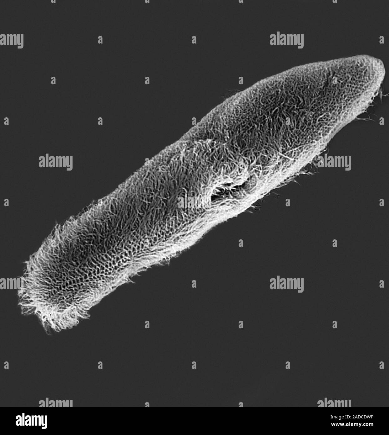 Paramecium sp., ciliated protozoan, scanning electron micrograph (SEM ... Paramecium sp., ciliated protozoan, scanning electron micrograph (SEM ...