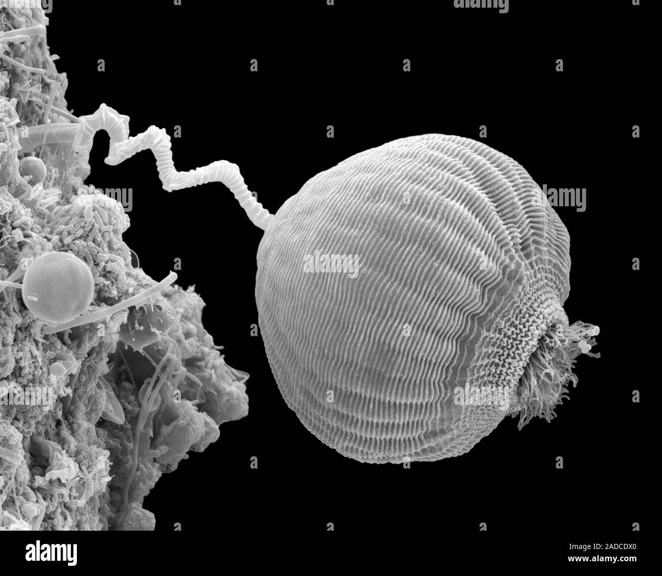 Vorticella sp., ciliated protozoan, scanning electron micrograph (SEM ... Vorticella sp., ciliated protozoan, scanning electron micrograph (SEM ...