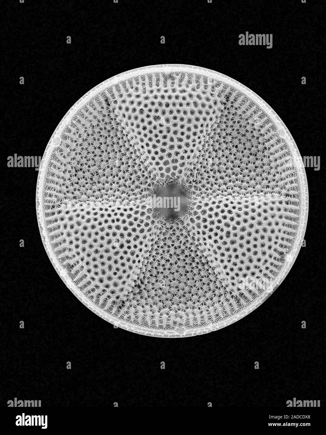 Scanning electron micrograph (SEM) of centric fossil diatom frustule ...