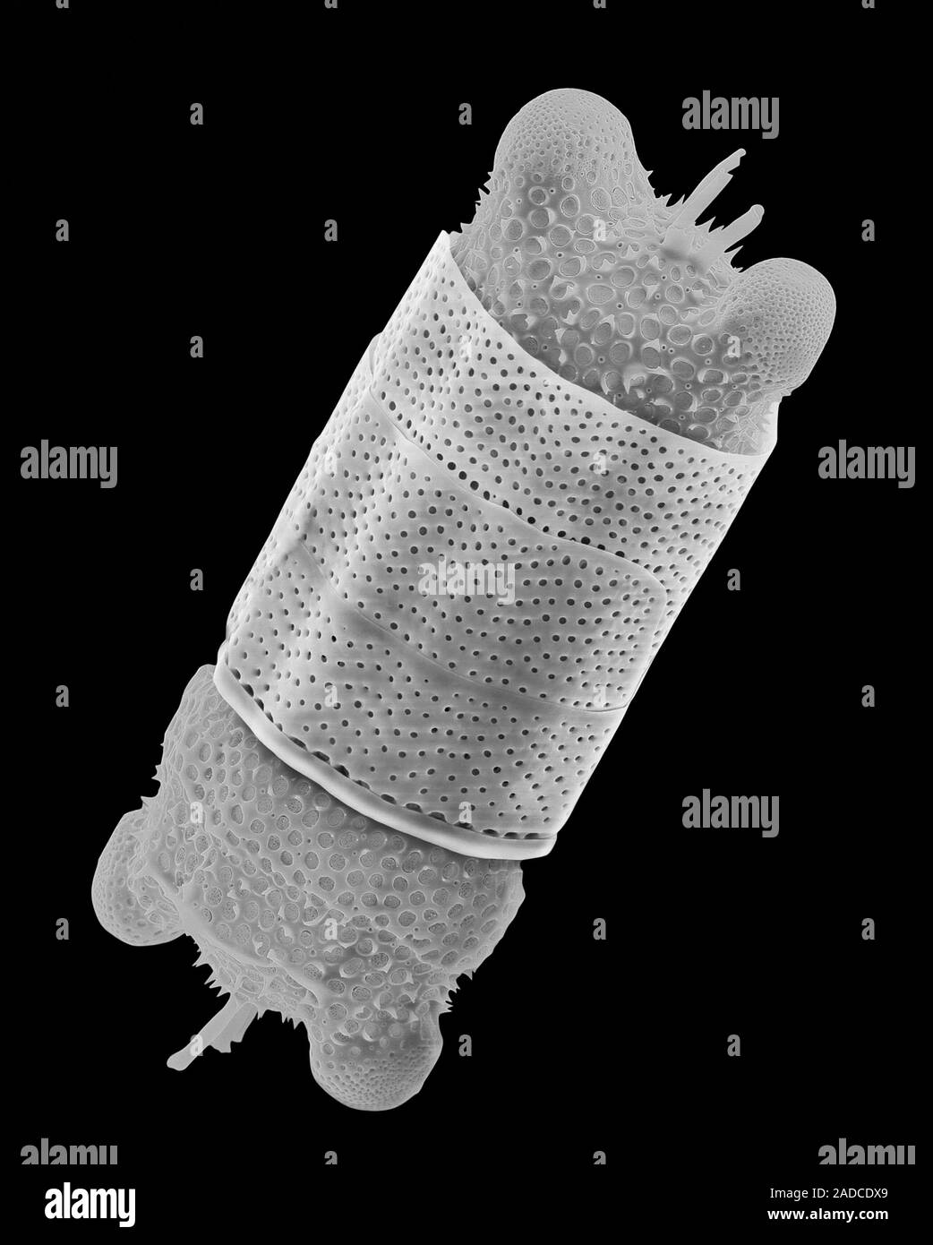 Scanning electron micrograph (SEM) of marine centric diatom frustule ...
