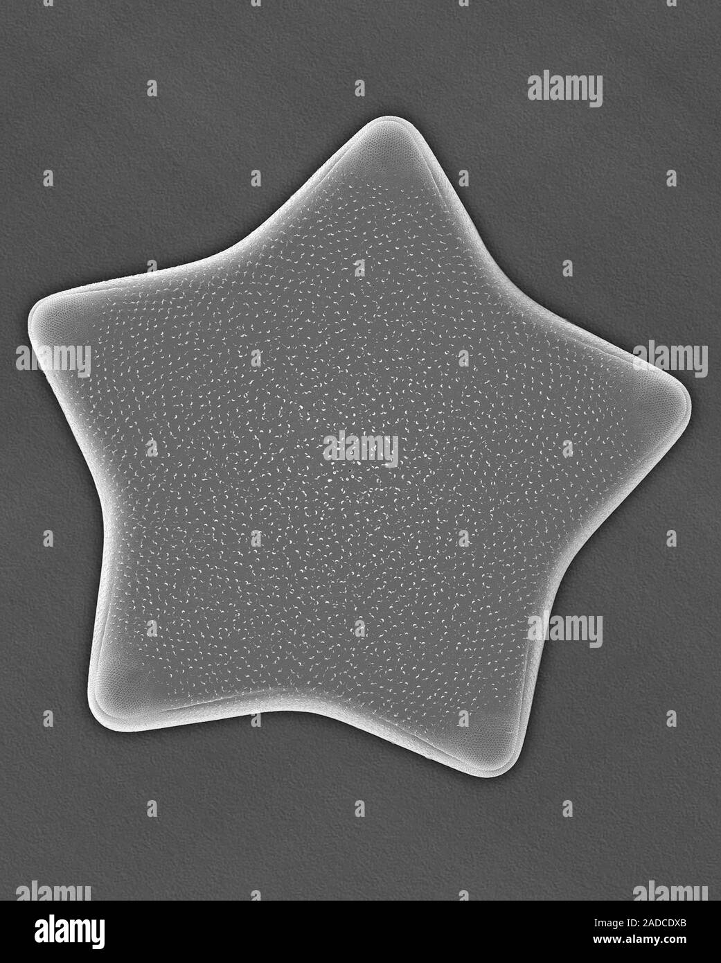 Scanning electron micrograph (SEM) of marine diatom (Triceratium ...