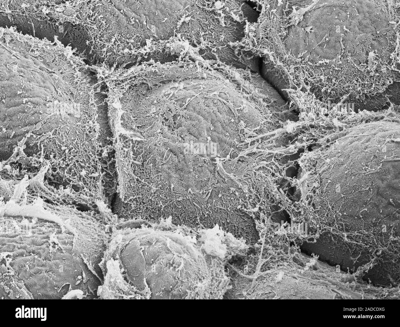Scanning electron micrograph (SEM) of coralline red alga (branched type ...