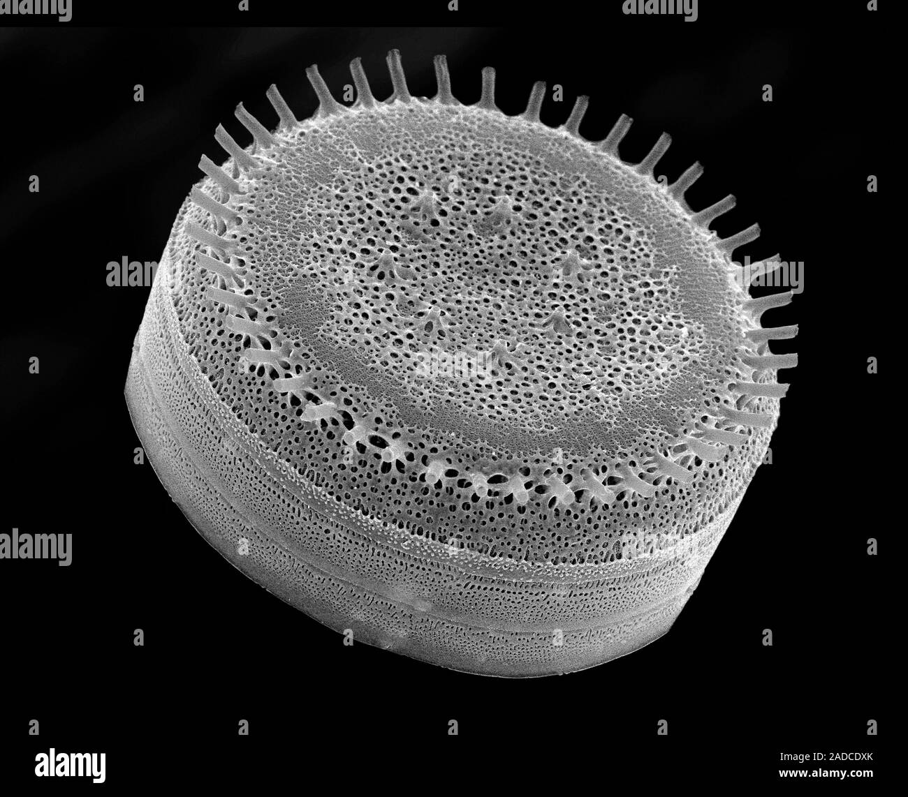 Scanning electron micrograph (SEM) of fresh water centric diatom frustule (skeleton), Cyclotella ...