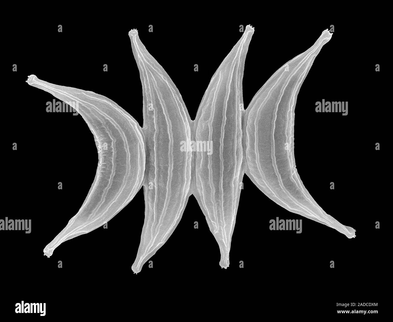 Scanning electron micrograph (SEM) of Scenedesmus sp., flat colony of 4 ...