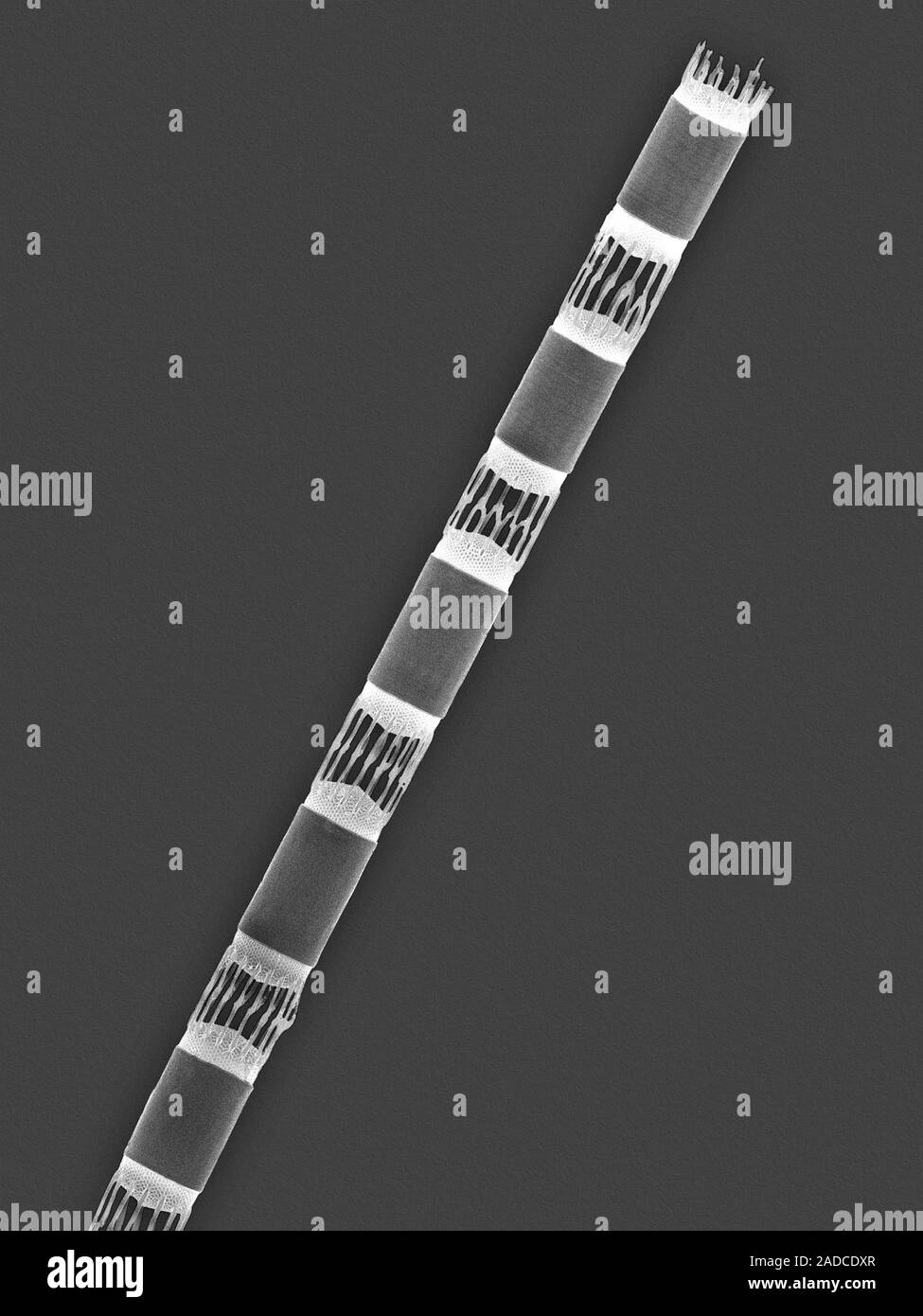 Scanning electron micrograph (SEM) of marine, filamentous, centric ...