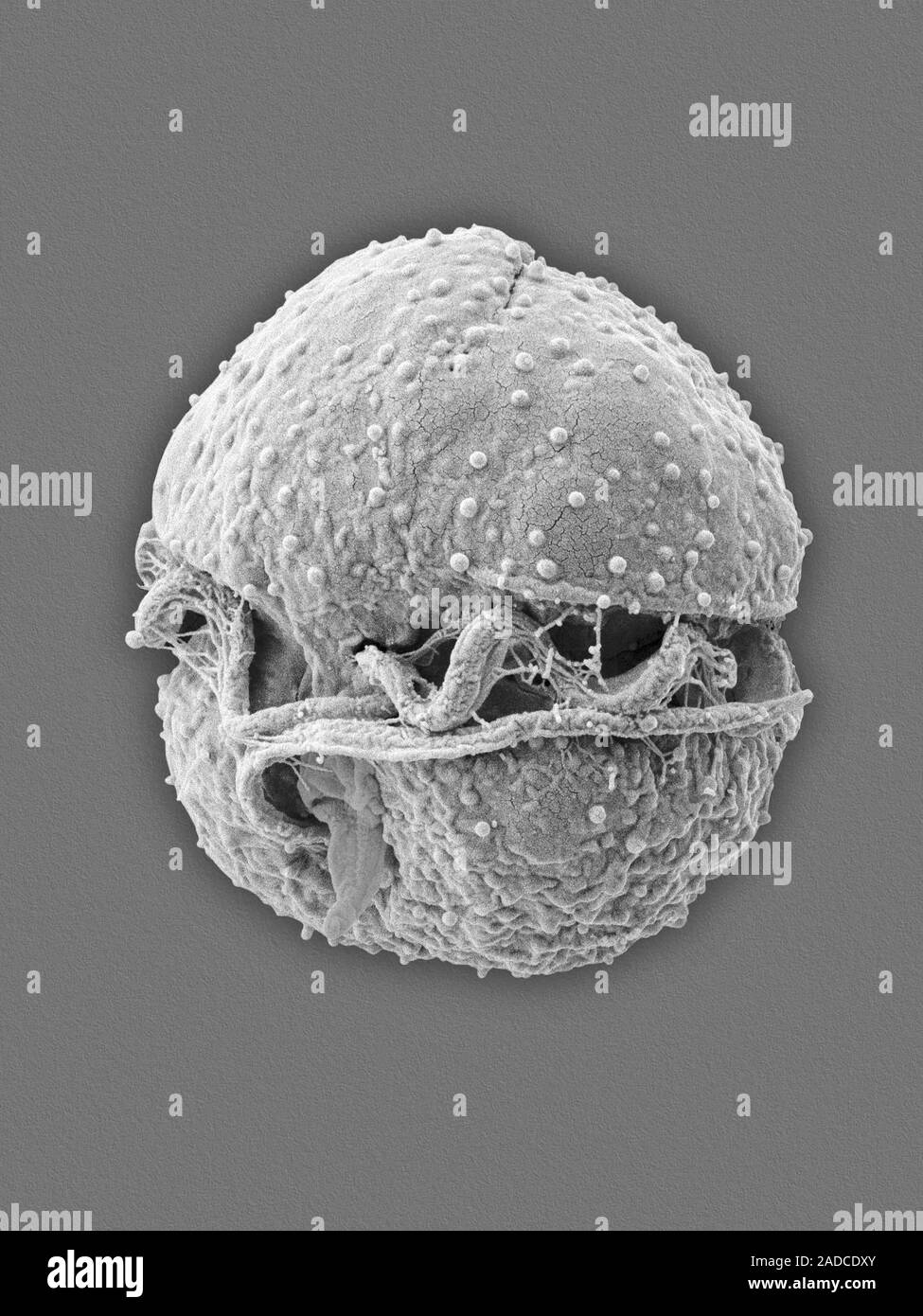 Scanning electron micrograph (SEM) of toxic heterotrophic ...
