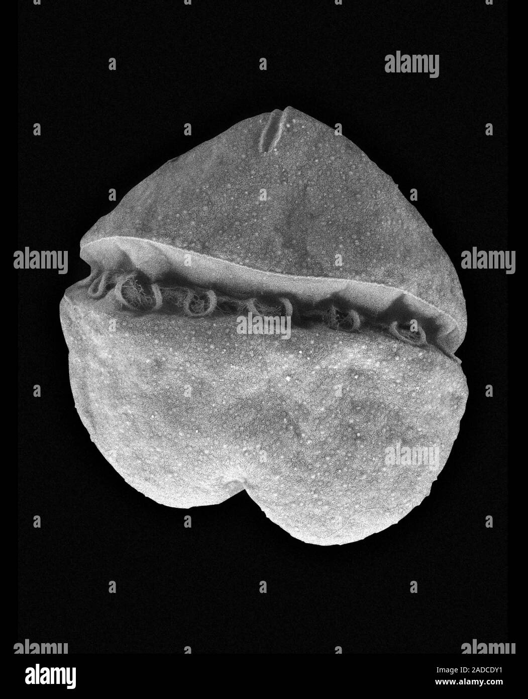 Scanning electron micrograph (SEM) of toxic marine dinoflagellate ...