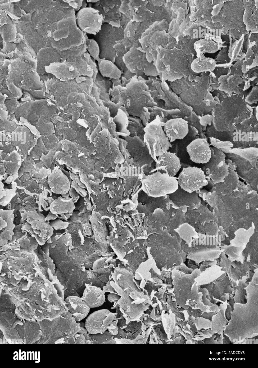 Scanning electron micrograph (SEM) of Coal degrading archaea (unknown ...