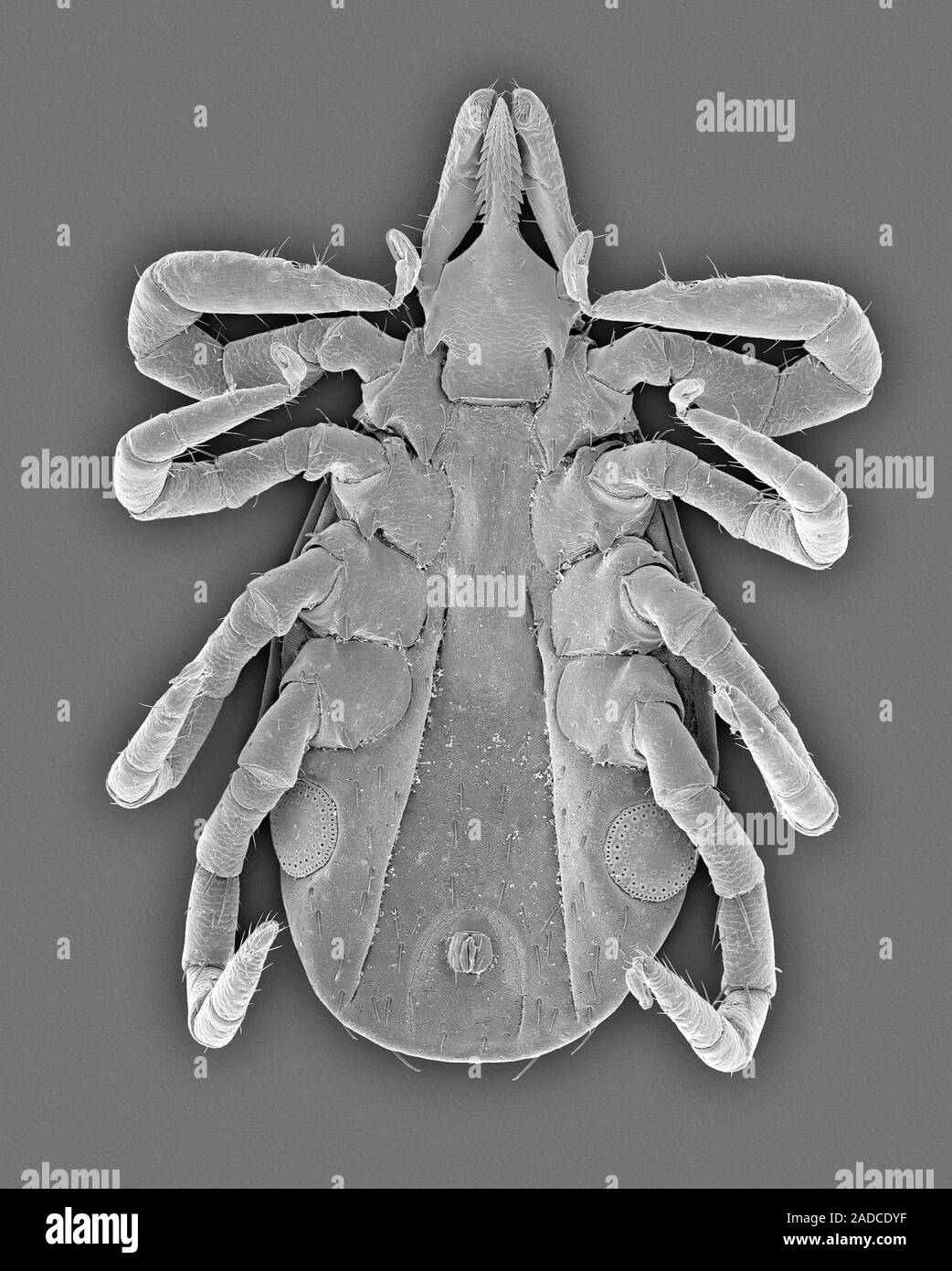 Scanning electron micrograph (SEM) of Deer tick (Ixodes scapularis). A ...