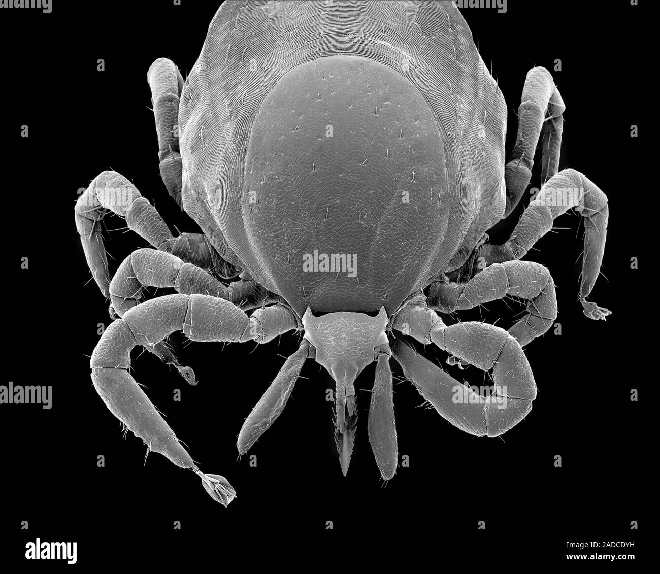 Scanning electron micrograph (SEM) of Deer tick (Ixodes scapularis). A ...