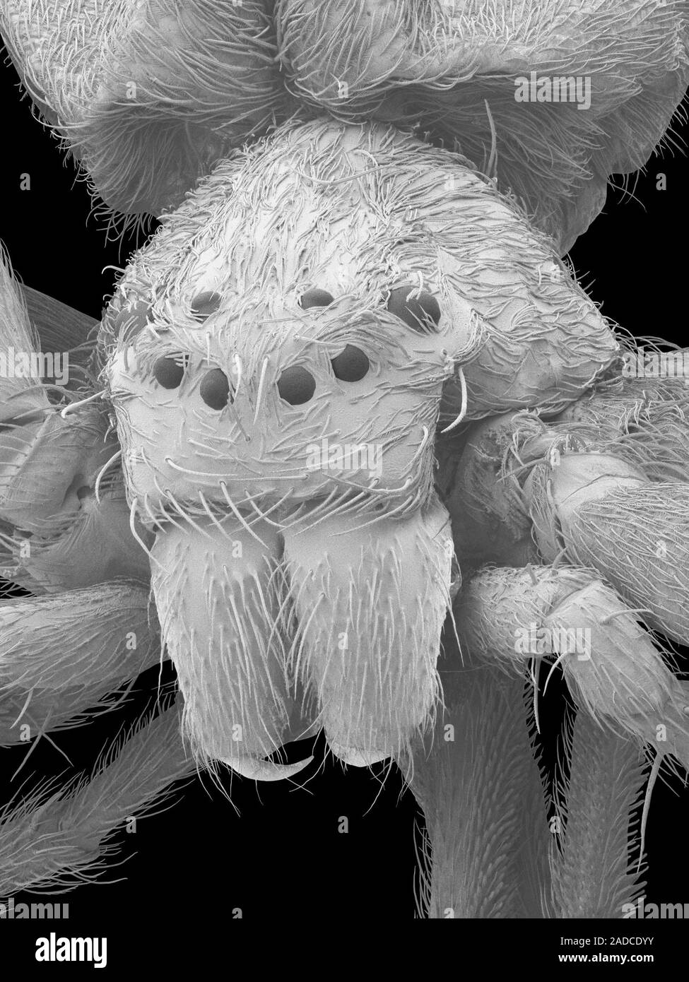 Scanning electron micrograph (SEM) of diving bell spider abdomen ...
