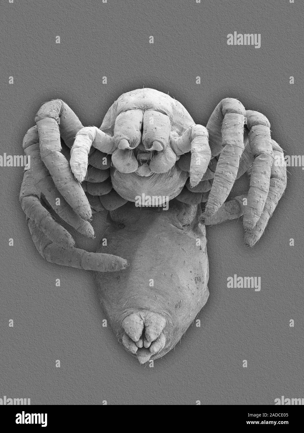 Scanning electron micrograph (SEM) of Riparin sac spider spiderling ...