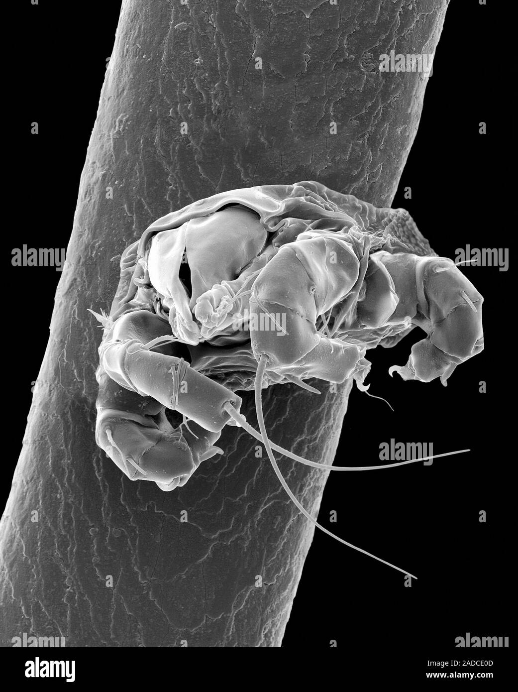 Scanning electron micrograph (SEM) of Mite (unknown) on human hair. The ...