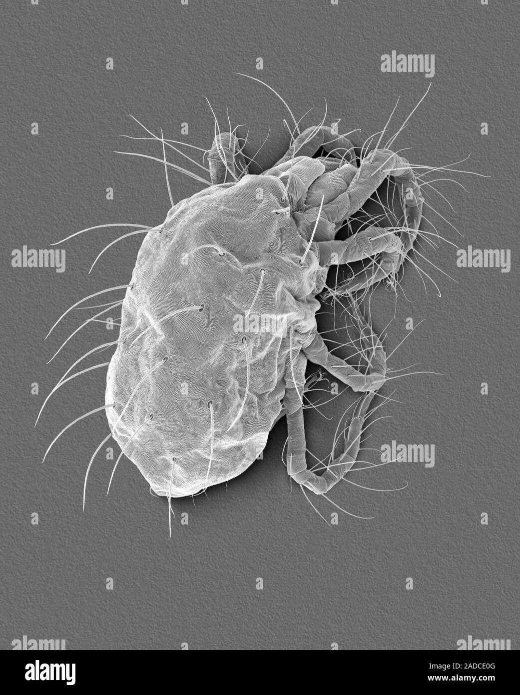 Scanning electron micrograph (SEM) of Two-spotted spider mite ...