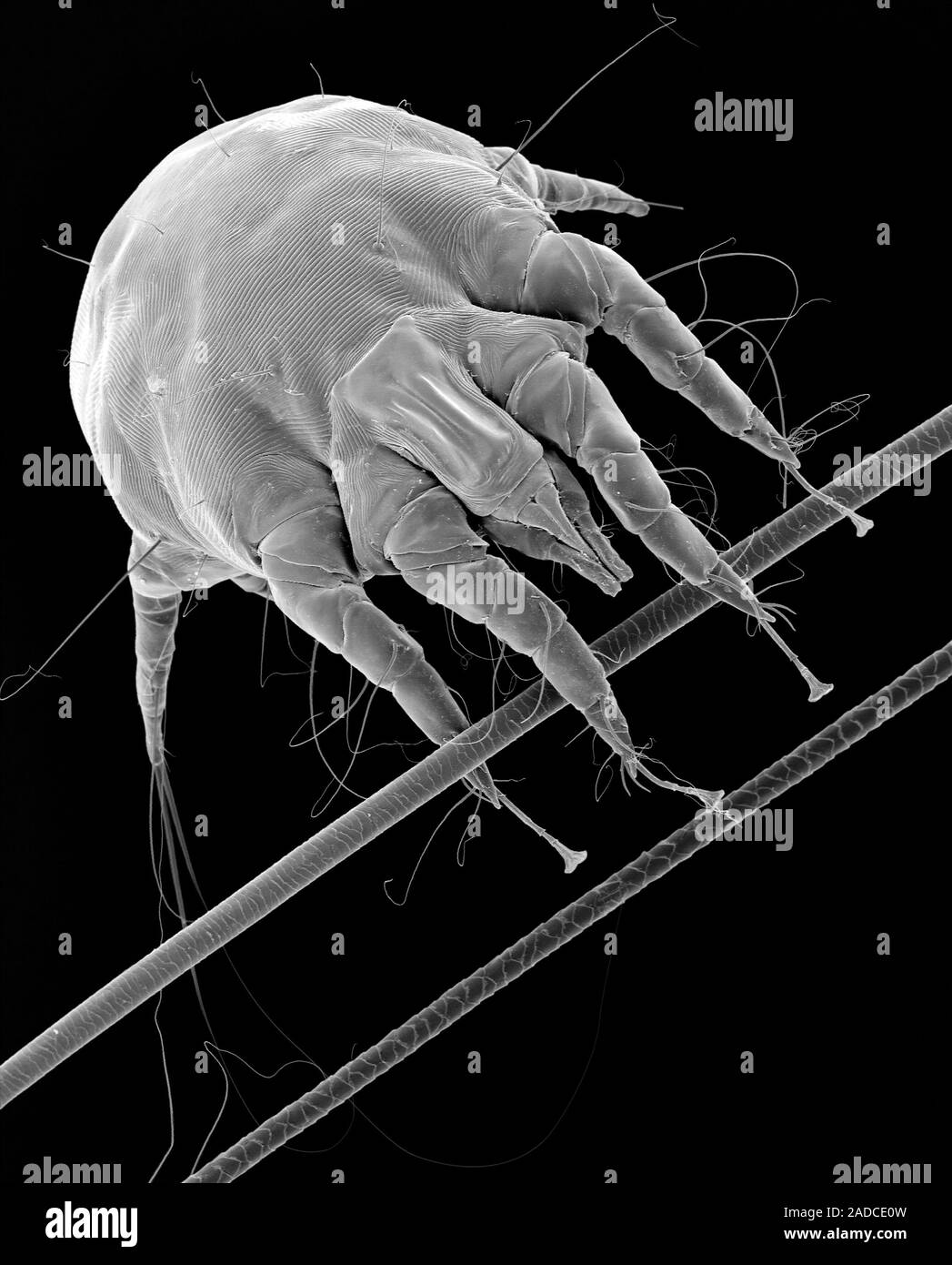Scanning electron micrograph (SEM) of Rabbit ear mite (Psoroptes ...