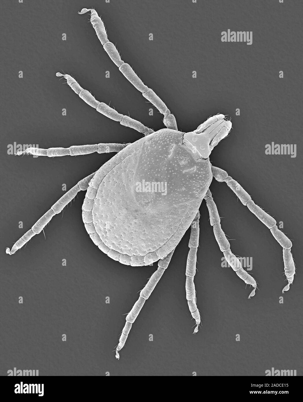 Scanning electron micrograph (SEM) of Lone star tick (Amblyomma ...