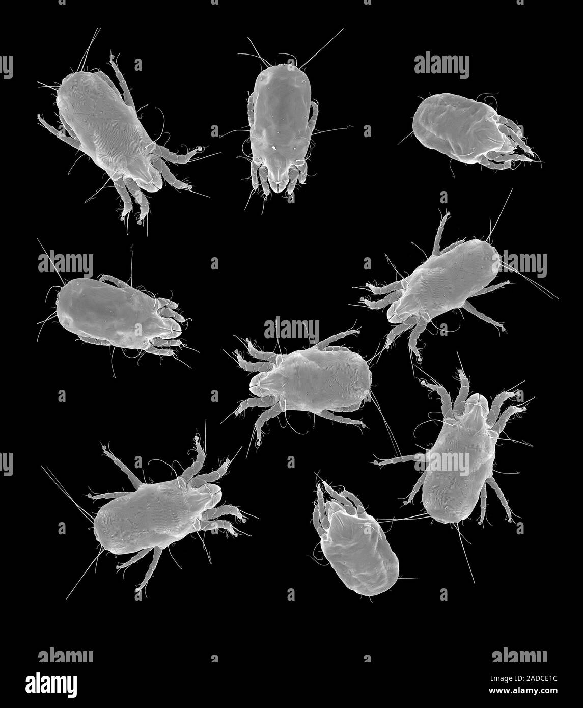 Scanning electron micrograph (SEM) of Dust mites (Dermatophagoides sp ...