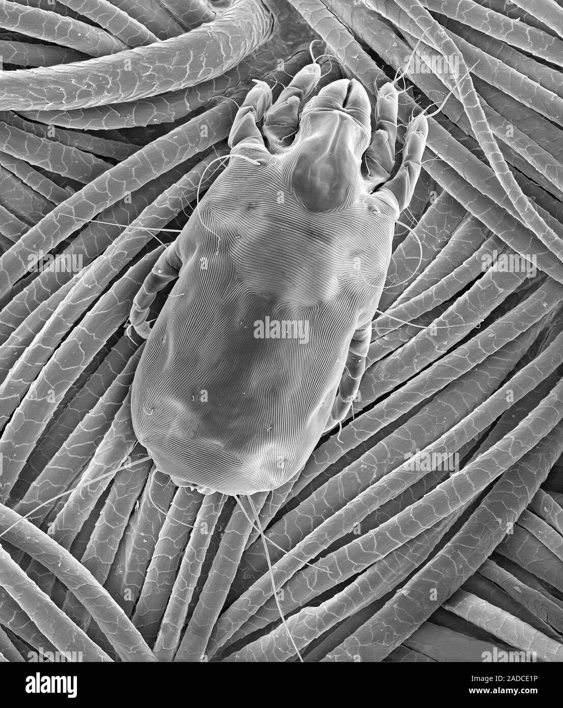 Scanning electron micrograph (SEM) of Dust mite (Dermatophagoides sp ...