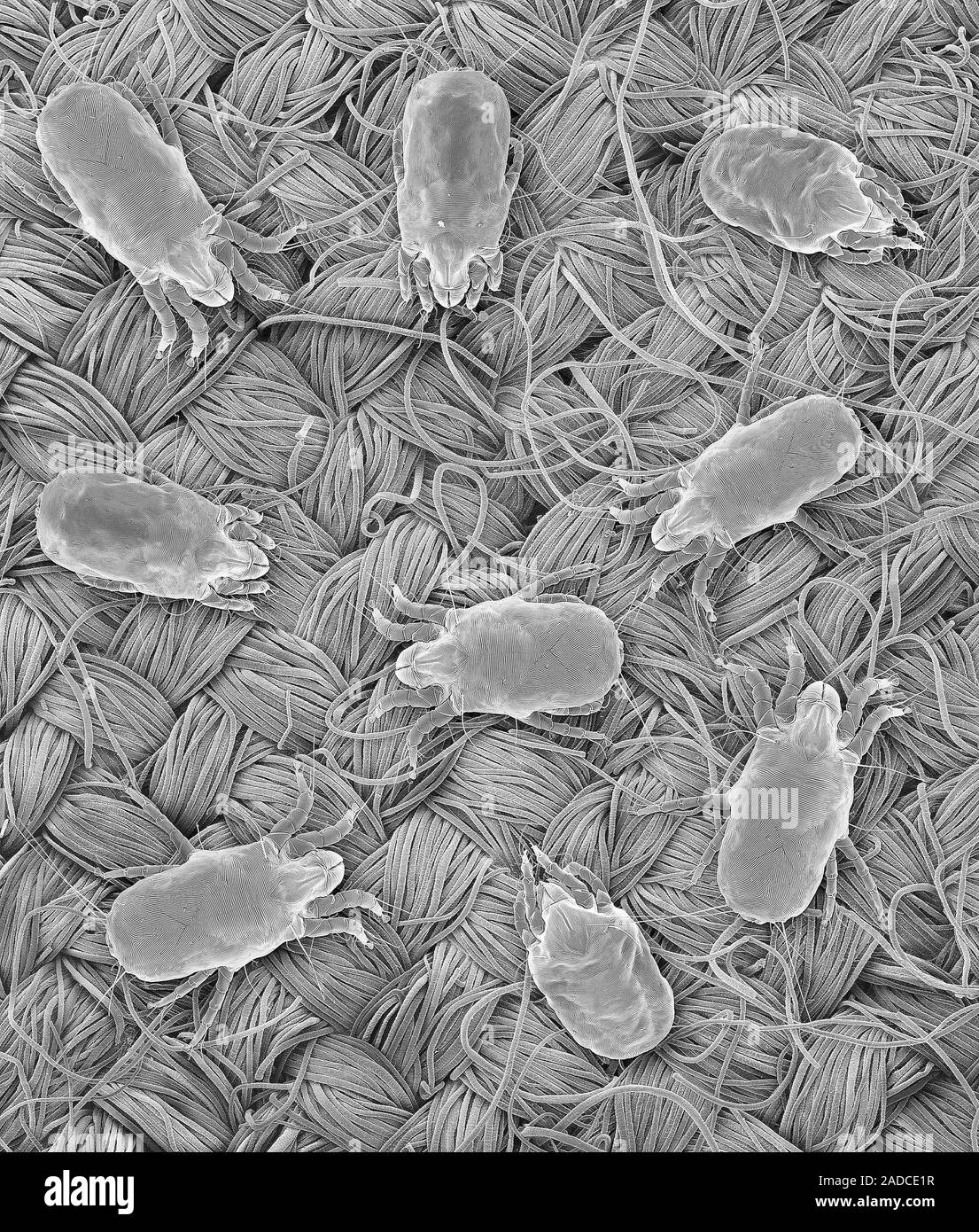 Scanning electron micrograph (SEM) of Dust mites (Dermatophagoides sp ...