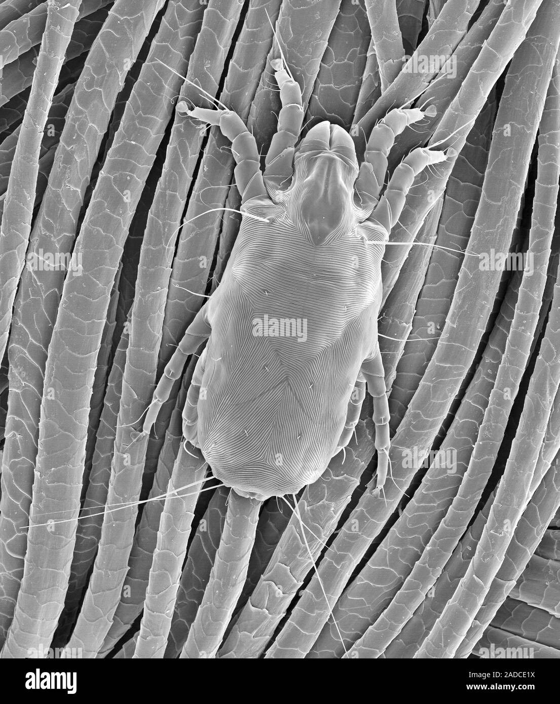Scanning electron micrograph (SEM) of Dust mite (Dermatophagoides sp ...