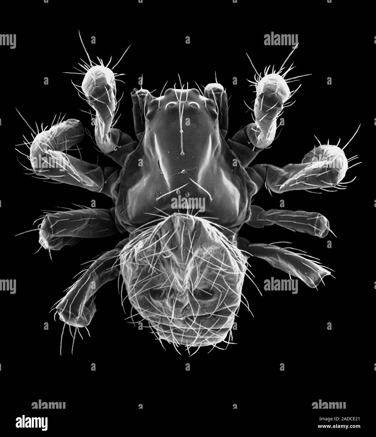 Scanning electron micrograph (SEM) of Hammock spider (Pityohyphantes ...