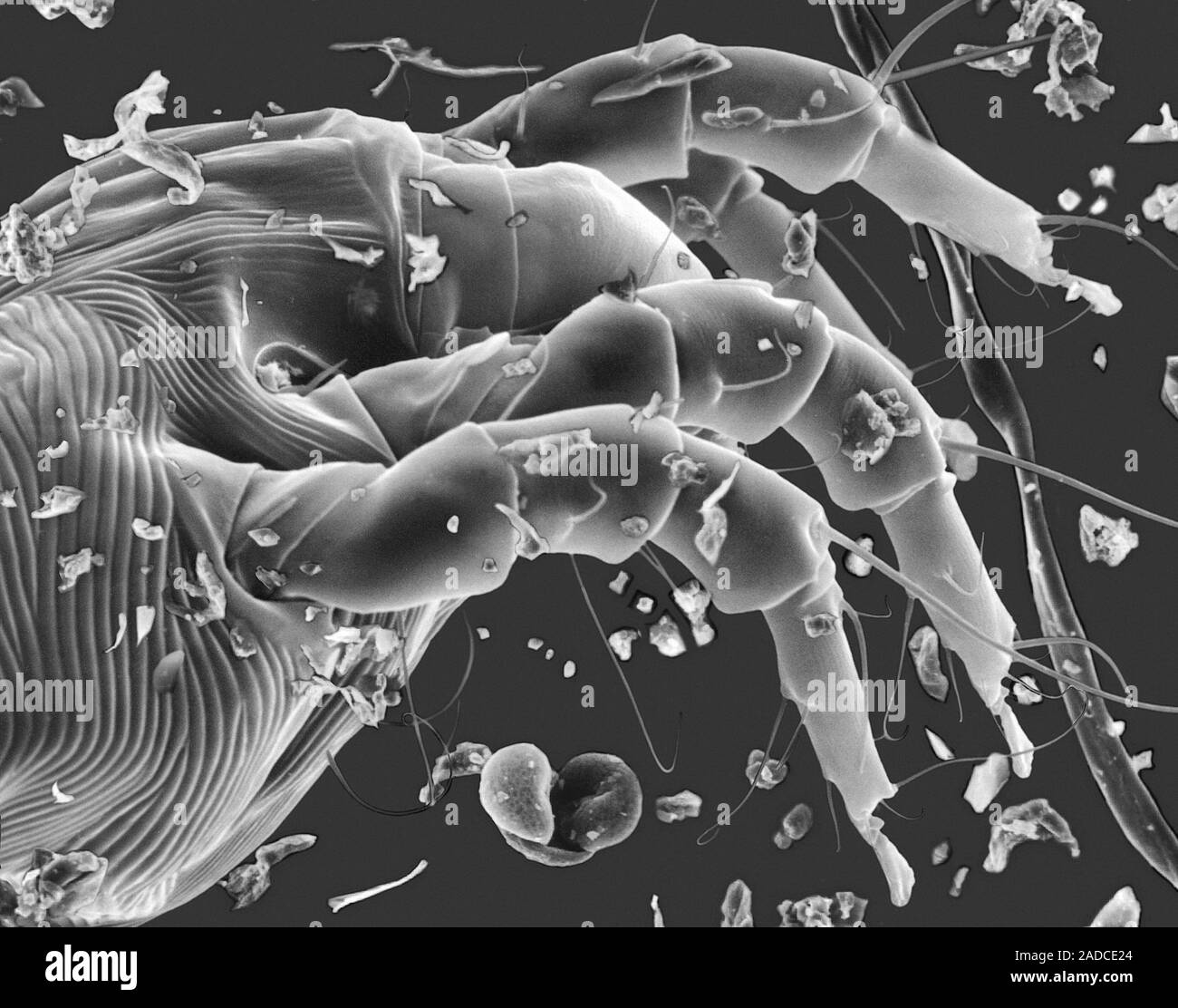 Scanning electron micrograph (SEM) of Dust mite -head and anterior legs ...