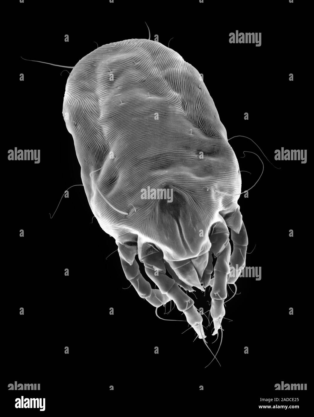 Scanning electron micrograph (SEM) of Dust mite (Dermatophagoides sp ...