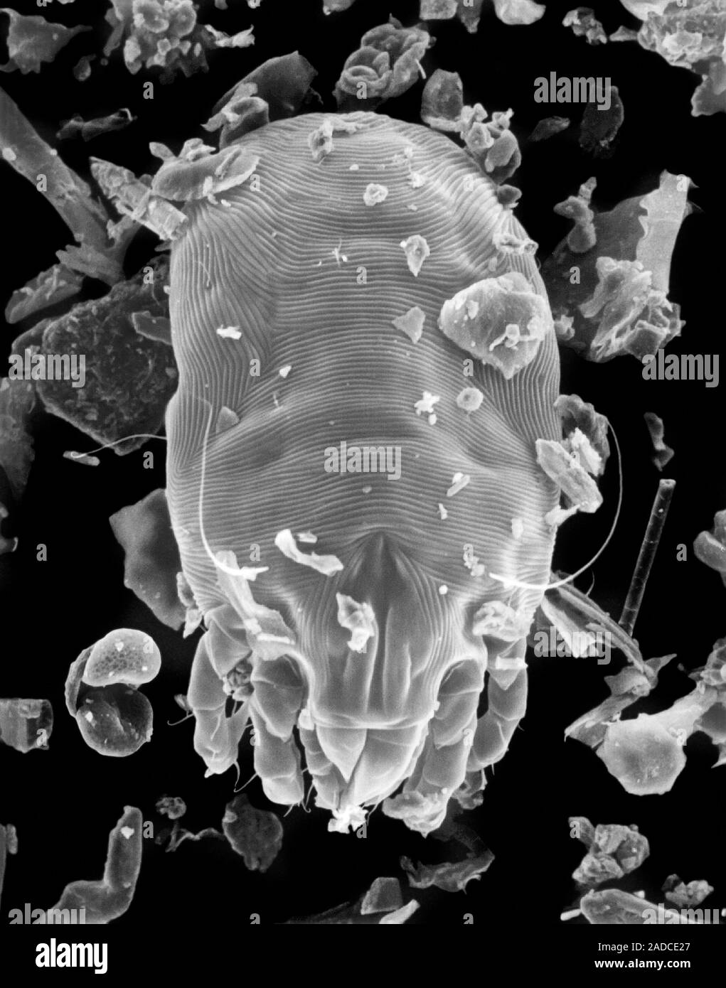 Scanning electron micrograph (SEM) of Dust mite (Dermatophagoides sp ...