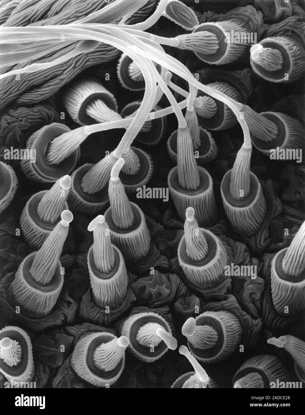 Scanning electron micrograph (SEM) of Spiny-back (orb weaver) spider ...