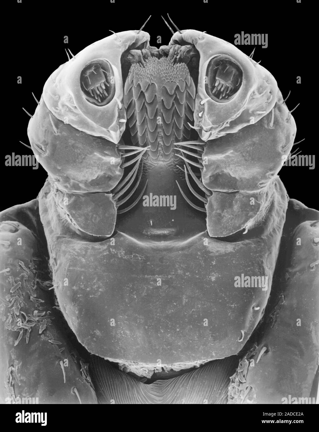 Scanning electron micrograph (SEM) of American dog tick head ...